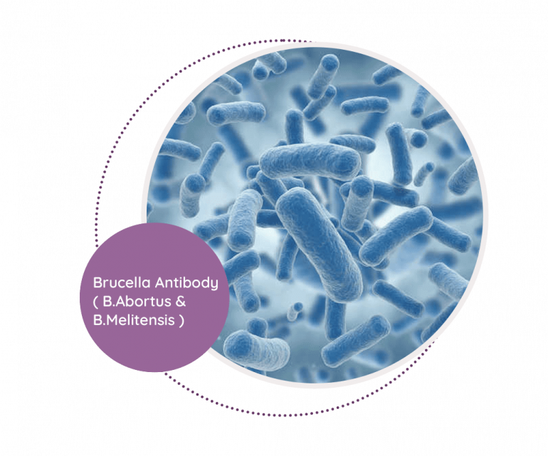 Brucella Antibody (B.Abortus & B.Melitensis) - MediScan Lab