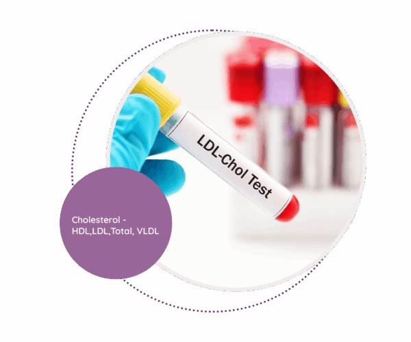 Cholesterol - MediScan Lab