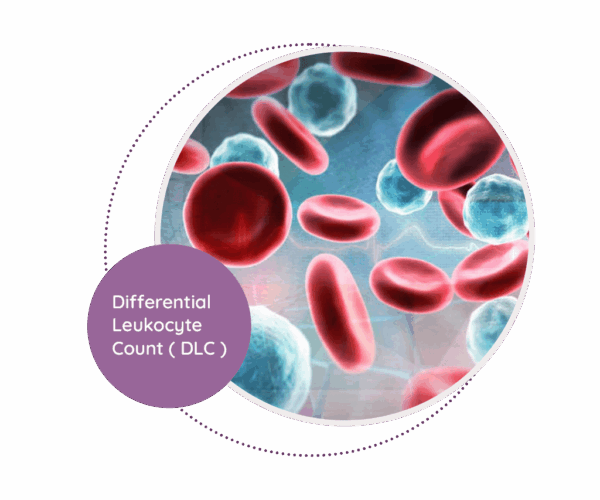 Differential Leukocyte Count - MediScan Lab