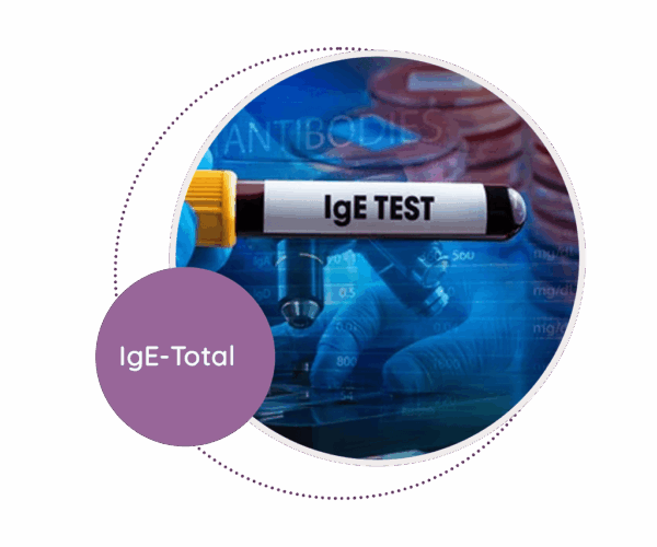 IgE-Total - MediScan Lab