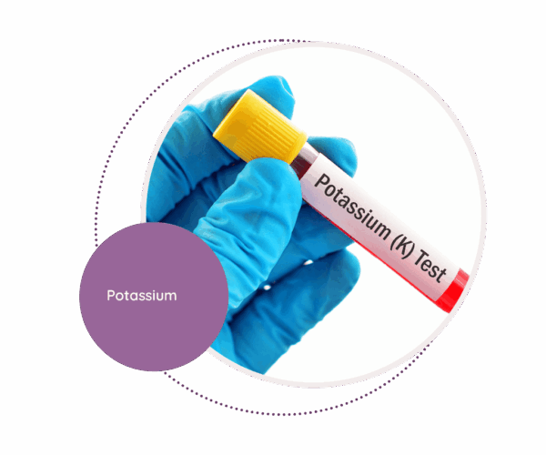 Potassium - MediScan Lab