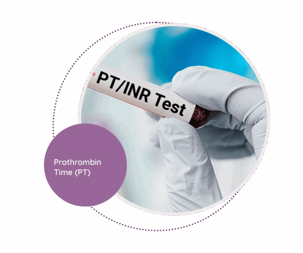 Prothrombin Time (PT) - MediScan Lab